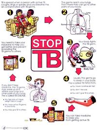 Stop TB | National Prevention Information Network | Connecting public ...